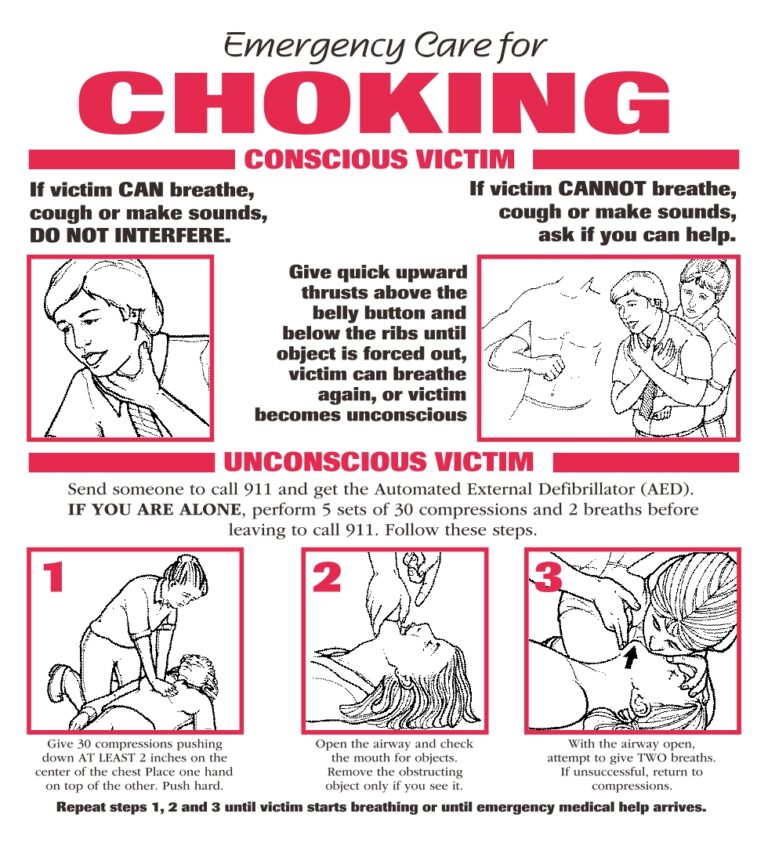 Printable First Aid Choking Poster - Printable JD