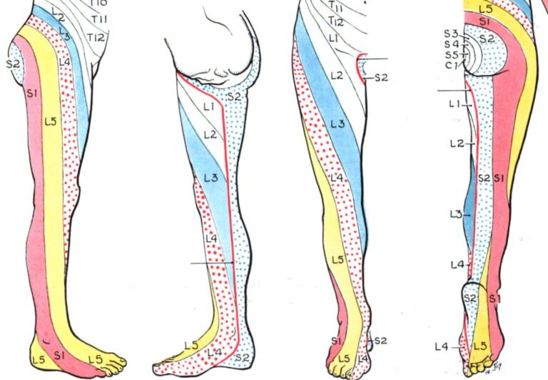 Printable Leg Dermatomes - Printable JD
