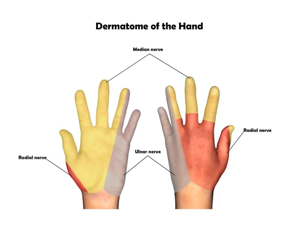 Printable Sensory Dermatome Of Hand - Printable JD