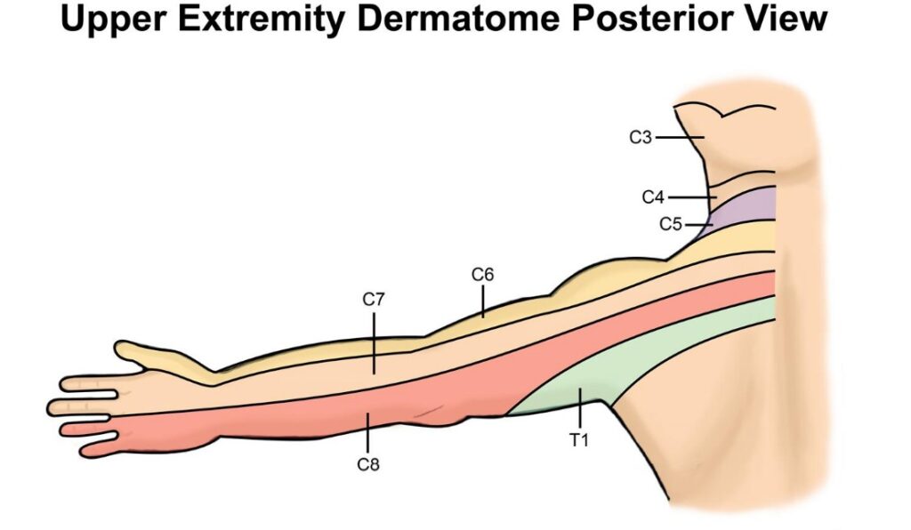 Printable Sensory Dermatome Of Hand - Printable JD