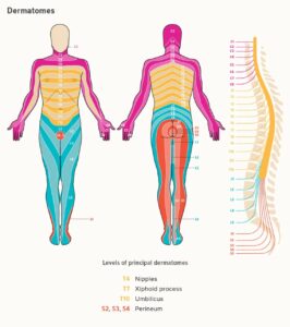 Printable Shingles Dermatome Map - Printable JD