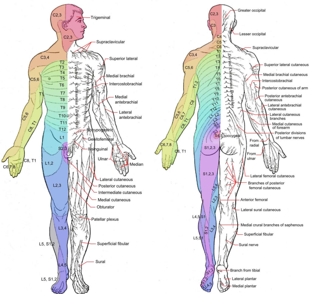Printable Shingles Dermatome Map - Printable JD